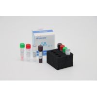 Quality Treponema Pallidum TP Virus Fluorescent RT PCR Kit Fast HCV Real Time PCR Kit for sale