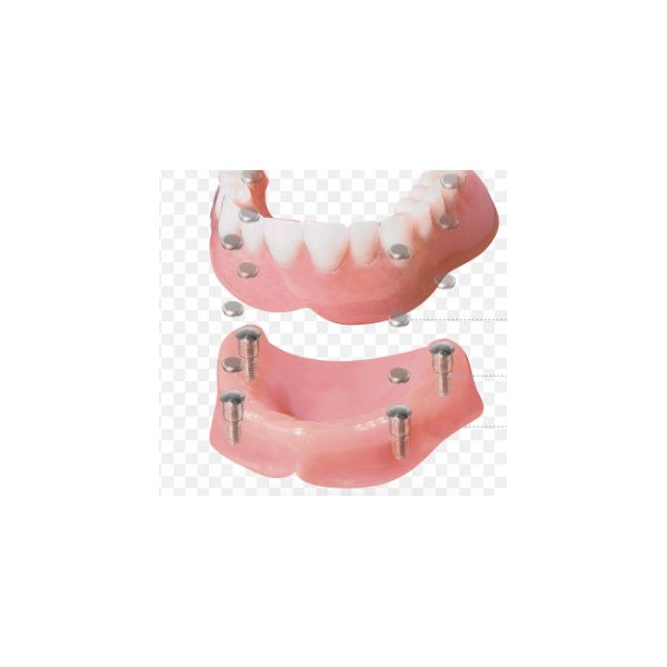 Quality High Precision Dental Magnetic Attachment Surface Polishing And Customizable for sale