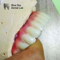 Quality Nature Surface Universal Compatible Multiple Choices Implant operation cases for for sale