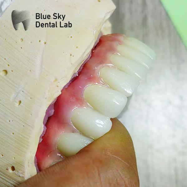 Quality Nature Surface Universal Compatible Multiple Choices Implant operation cases for for sale