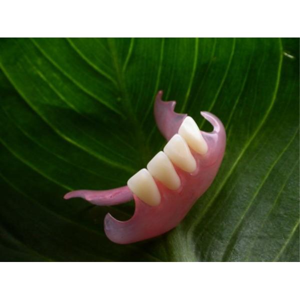 Quality Duraflex Flexible Partial Detachable Esthetic Partial Denture for sale