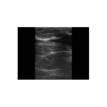 Quality B / W Palm Ultrasound Scanner Animal Ultrasound Scanner Using for Checking Mare for sale