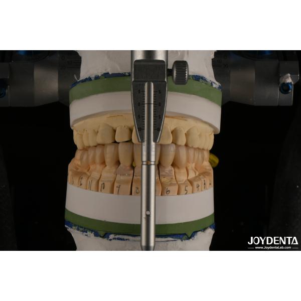 Quality High Aesthetics Porcelain Layered Dental Zirconia For Implant Restorations for sale