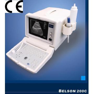 Portable Ultrasound Scanner Color Doppler Machine With 15 Inch LCD Monitor