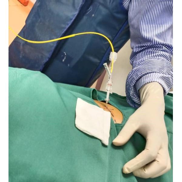 Quality 980nm PLDD Minimally Invasive Laser for sale