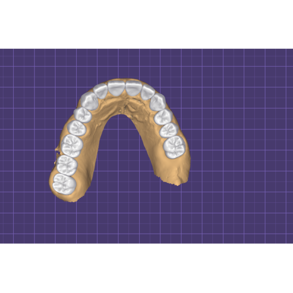 Quality Precision Fit Digital Wax Up Dental Study Model with Durable and Biocompatible for sale