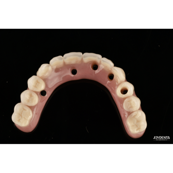 Quality Redefining Full Arch Prosthetics: Unmatched Fit and Function with Our Ti-Base for sale