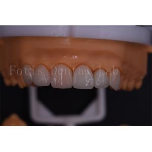 Quality 1 Day Digital Crowns Excellent Compatibility With Easy Transmission Via Email Or for sale