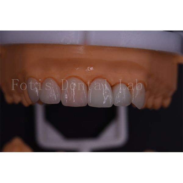 Quality 1 Day Digital Crowns Excellent Compatibility With Easy Transmission Via Email Or Software for sale