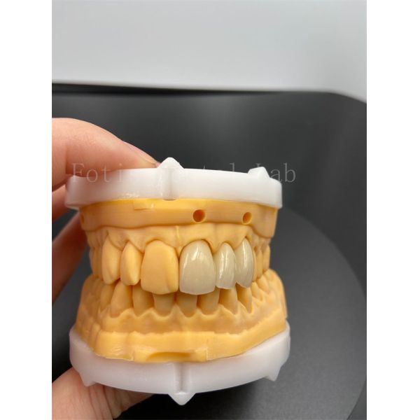 Quality Precision Fit Digital Crowns Implant Dentrues With Compatibility Email Transmission Mode for sale