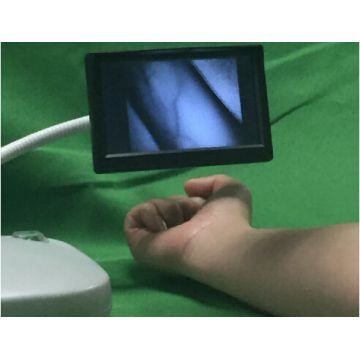 Quality 5 Inch Screen Portable Vein Imaging Device Infrared Vein Finder For Patients for sale