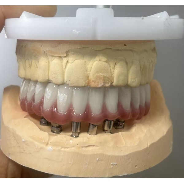 Quality Full Zirconia Dental Crown with Abutment - Biocompatible and High Strength Zirconia Material for sale