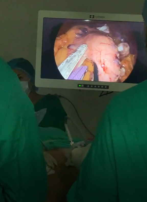 surgery