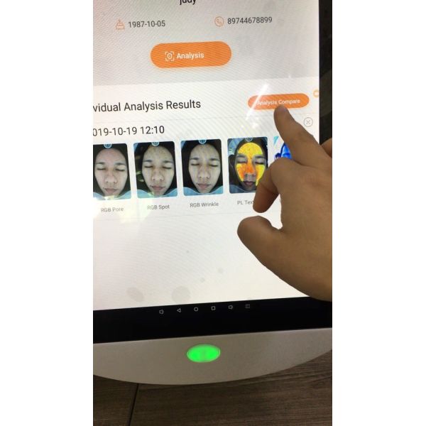 Quality Cosmetics Skin Analyzer Product Suggestion Database 2 Years Warranty for sale