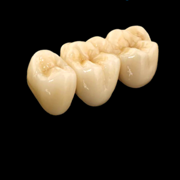 Quality White High Noble Precious Alloy Crown And Bridge Accurate And Custom for sale
