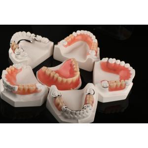 Quality Hypoallergenic Acrylic Dental Removables Artificial Teeth Removable Partial for sale