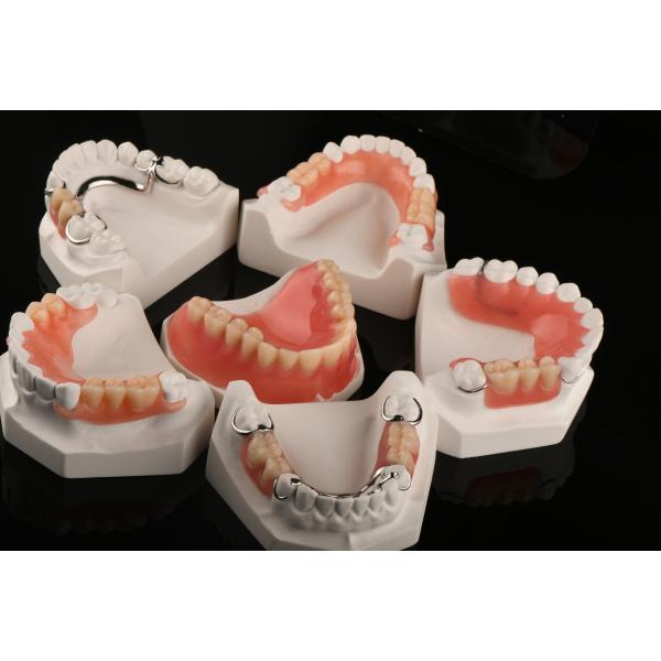 Quality Hypoallergenic Acrylic Dental Removables Artificial Teeth Removable Partial for sale