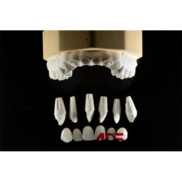 Quality Dental Porcelain Feldspathic Veneers For Teeth Custom Shaped for sale