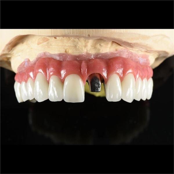 Quality Fixed Restorations Full Arch Zirconia Implant Bridge Denture Teeth for sale