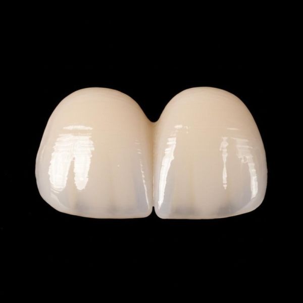 Quality Dental Veneers for Missing Teeth | Global Premium Dental Lab Services for sale