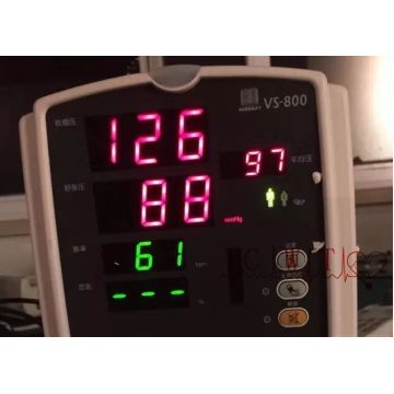 Quality VS800 RESP NIBP SPO2 Used Patient Monitor Mindray Cardiac Monitor for sale