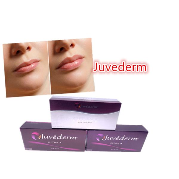 Quality Juvederm Hyaluronic Acid Dermal Filler 2ml Anti Winkles Facial Body Injection for sale