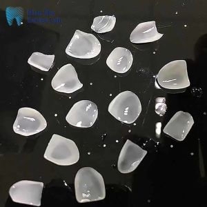 Quality Ultrathin E Max Veneers Ingot Class Ceramic Natural Looking Veneers for sale