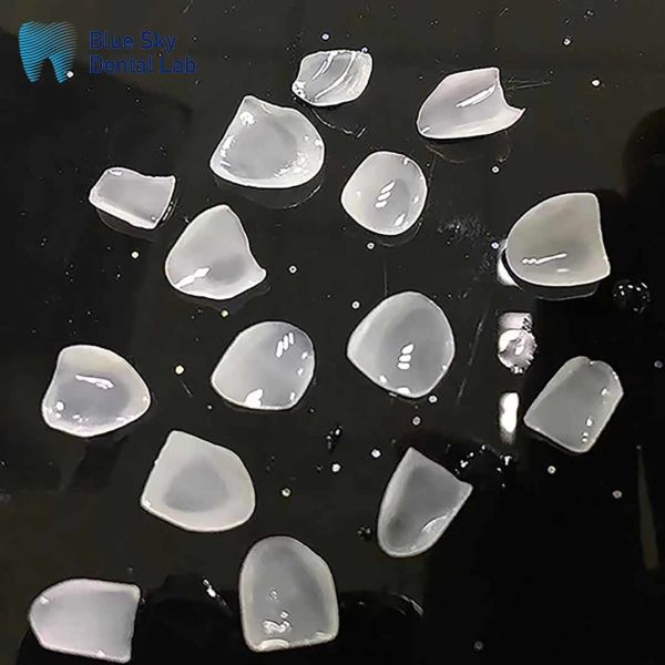 Quality Ultrathin E Max Veneers Ingot Class Ceramic Natural Looking Veneers for sale
