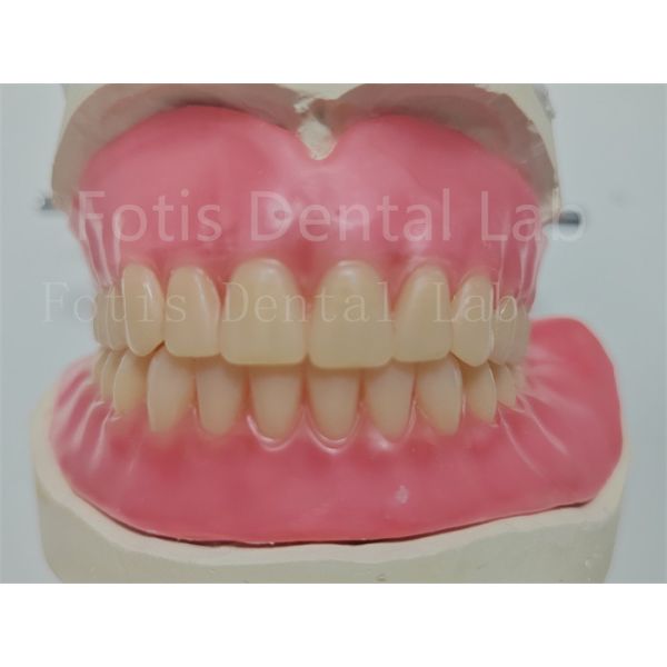 Quality Affordable Custom Full Acrylic Denture With Ivoclar Teeth Easy To Use for sale