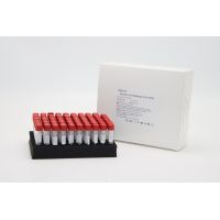 Quality Complete Test Manual Nucleic Acid Viral RNA Extraction Kit Lab Reagent Nasal for sale