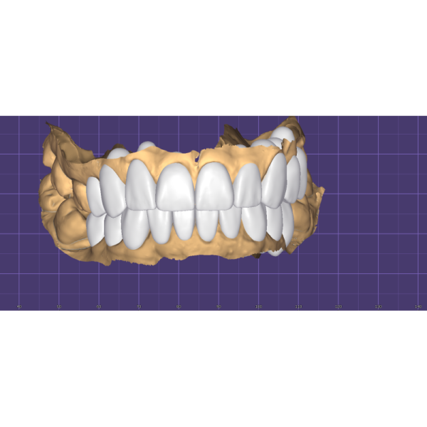 Quality Precision Fit Digital Wax Up Dental Study Model with Durable and Biocompatible 3D Printed Design for sale