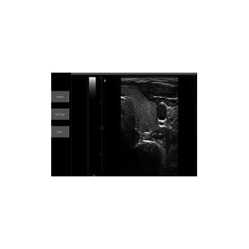 Quality Ultrasound Scan Equipment Portable Ultrasound Scanner Ipad Ultrasound Machine for sale