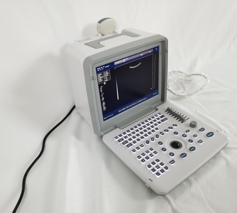 See Portable Pregnancy Laptop B W Scanner Wireless Fetal Doppler Probe Ultrasound Machine For Baby