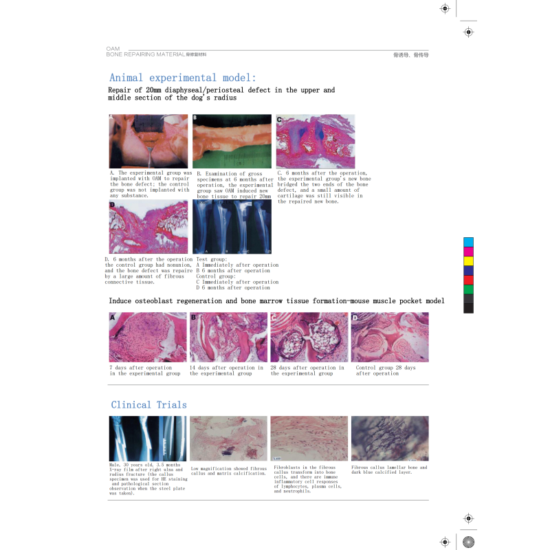 2g Bone Dfect Substitute Trauma Spine Osteoinductive Activity Graft