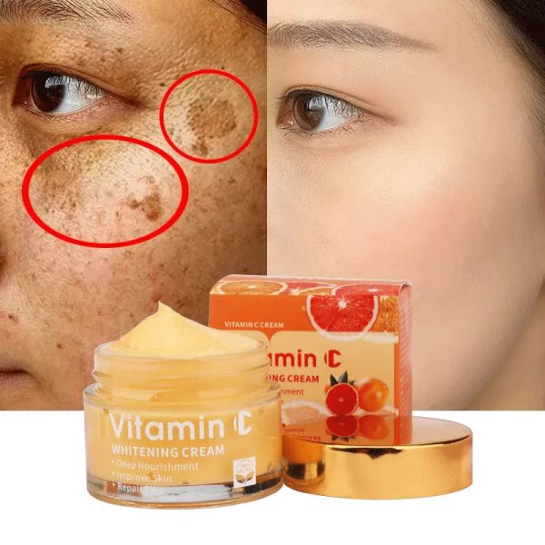 Quality Face Cream Whitening Moisturizer Anti Aging Acne Vitamin C Black Spot Remover Cream for sale