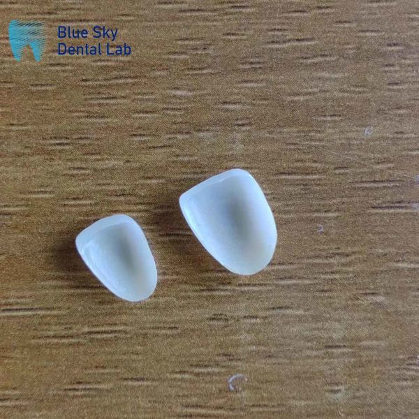 Quality 0.3mm Thin Glass Ceramic Veneer Implants Lightweight Veneer Cases for sale