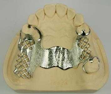 Quality Titanium Alloy Metal Framework for Removable Dentures - Lightweight and High for sale