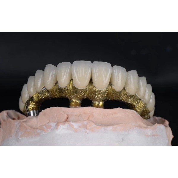Quality High Translucency Solid Implant Supported Crown Customizable For Dental for sale