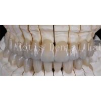 Quality Dental Lab Laminate Veneers for sale