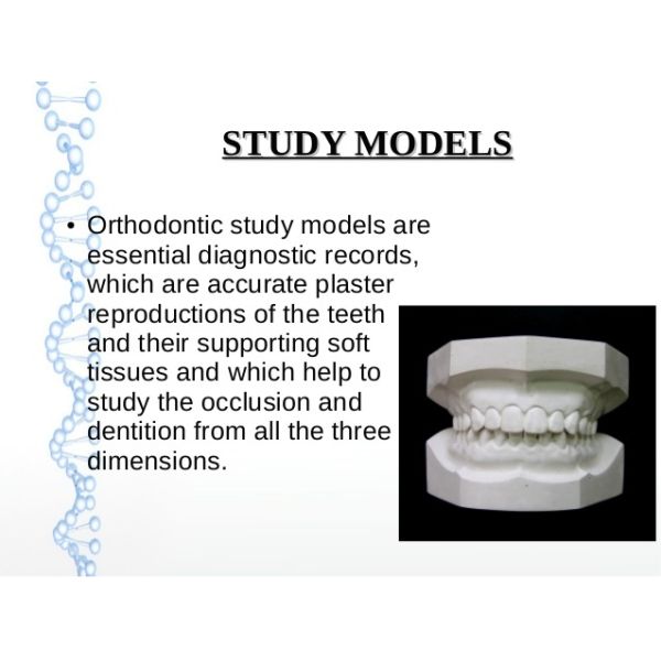 Quality Dental Study Model with CAD CAM Digital Design and 3D Printing Workflow for for sale