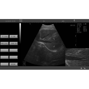 Quality Mini Ultrasound Machine Veterinary Ultrasound Scanner With 6.5MHz Linear Rectal for sale