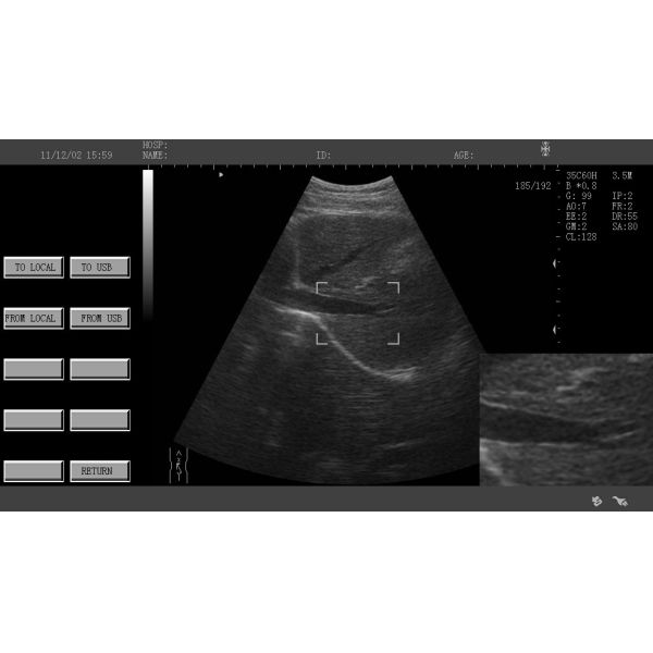 Quality Mini Veterinary Ultrasound Scanner for sale