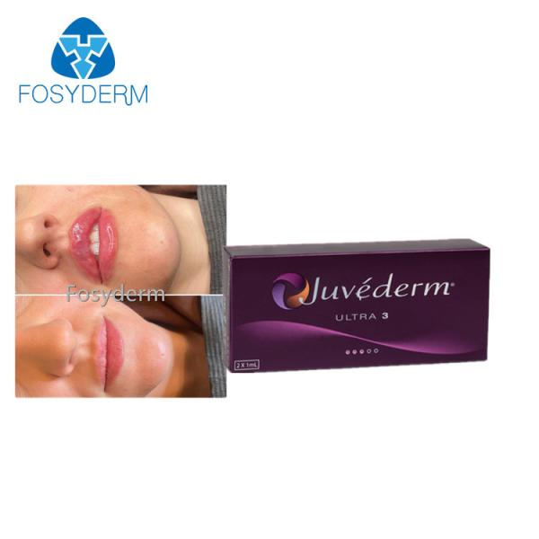 Quality 2x1ml Lip Enhancement Juvederm Dermal Filler Cross Linked Hyaluronic Acid for sale