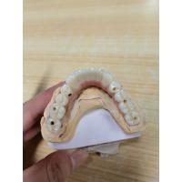 Quality Elevating Standards Our Dental Implant Crown Quality Assurance for sale