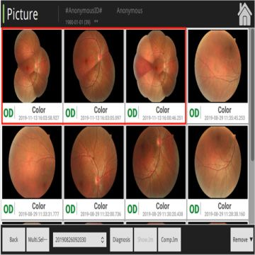 Quality Hyper Static Non Mydriatic Fundus Camera Machine 180 Degrees for sale