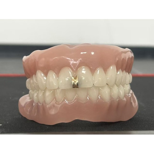 Quality Custom Full Denture with Natural Appearance and Comfortable Fit for Complete Arch Restoration for sale