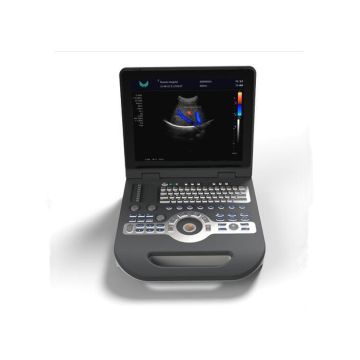 Quality Portable Ultrasound Scanner Color Doppler Machine With 15 Inch LCD Monitor for sale