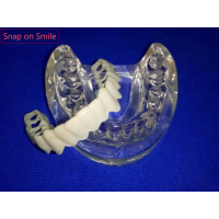 Quality Snap on Smile for sale