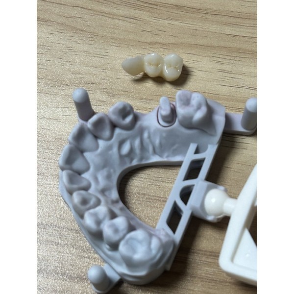 Quality Maryland Bridge with CAD/CAM Digital Technology for Minimally Invasive Single Tooth Replacement Using Zirconia Material for sale