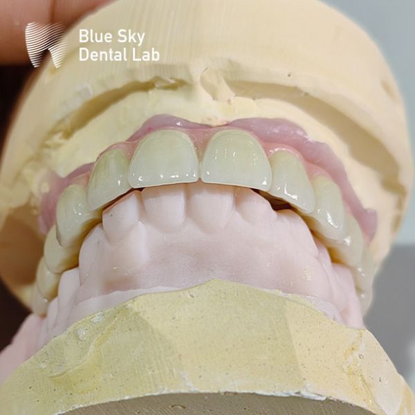 Quality Implant Operation Cases / Implant Procedure Cases for Diverse Implant Choices and Sterilizations for sale